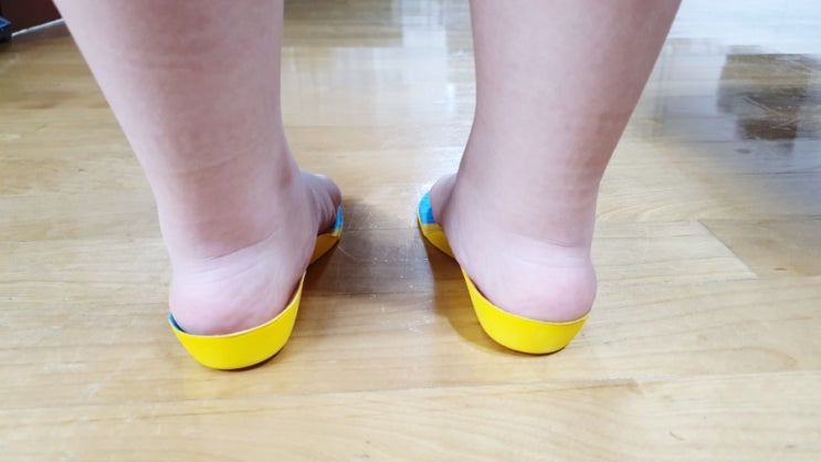 어린이다리교정 할 때 풋로직스키즈깔창이 도움 많이 되네요 네이버 블로그