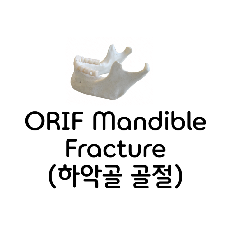 ORIF Mandible fracture (Mandibular fracture) 수술과정 : 네이버 블로그