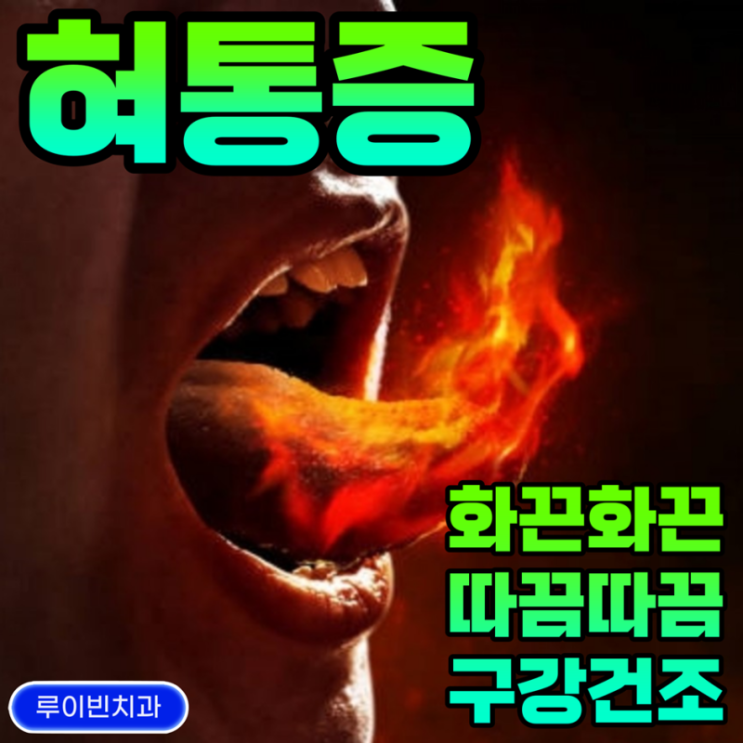 구강작열감 증후군 증상 설통 치료 병원 네이버 블로그