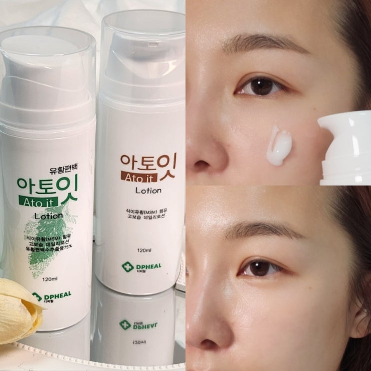 건조한 피부 로션 추천 악건성 민감성 건성 피부 케어 촉촉한 보습제 아토잇로션 으로 관리 네이버 블로그