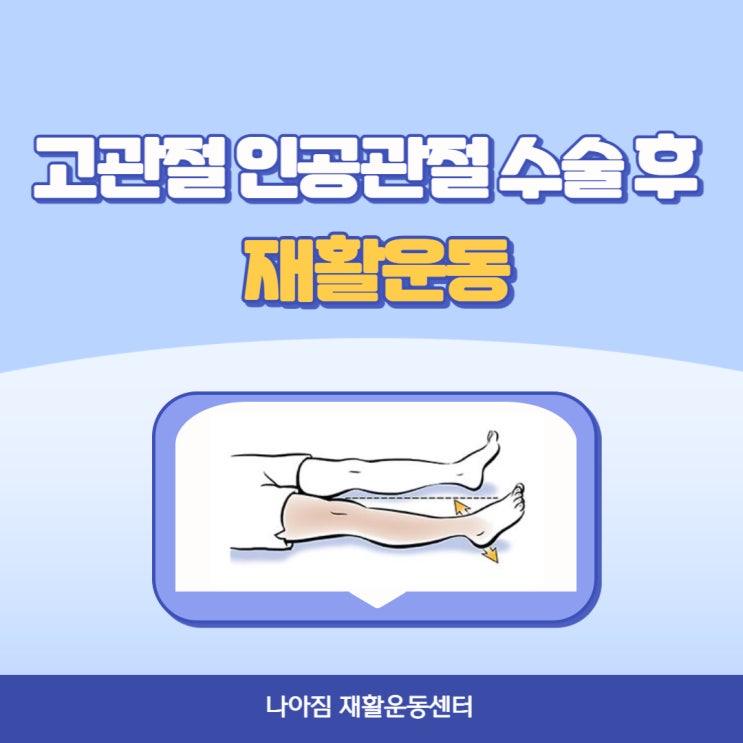 고관절 인공관절전치환술 수술후 초기 재활운동 접근법과 일상생활 필수 팁 네이버 블로그