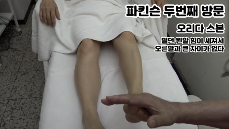 306. 영상 304번 파킨슨 두 번째 KSNS KSS 스본 스도 경과 : 네이버 블로그