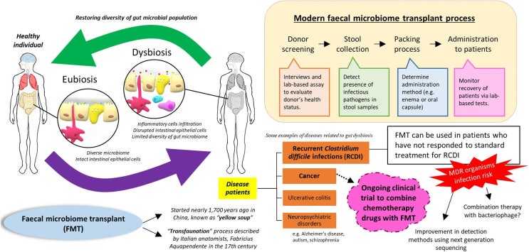 Fecal Microbiome Transplant (FMT)란? : 네이버 블로그