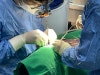 구미 수면치과 상악동거상술 임플란트 치료도 더 편안하게 네이버 블로그