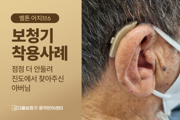 광주 벨톤보청기 어치브 오픈형 맞추신 이유 네이버 블로그