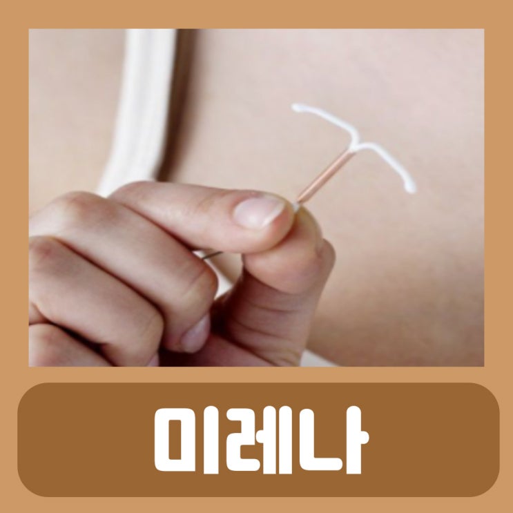 미레나 시술비용 시술 피임 체중증가 제거 루프 시술 통증 여성 피임 시술 방법 네이버 블로그