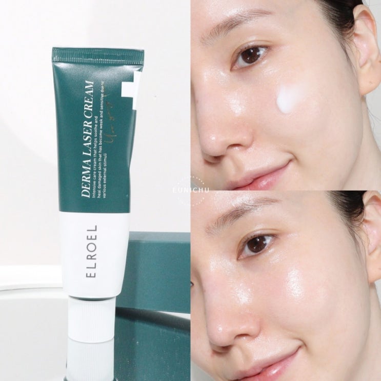 재생크림 추천 엘로엘 더마 레이저 크림 피부장벽강화를 위한 홈케어 진정회복크림 네이버 블로그