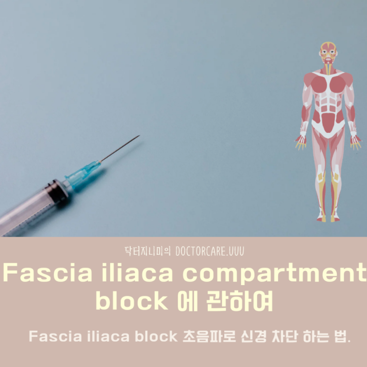 Fascia iliaca compartment block에 대한 모든 것 : 3-1 block : 네이버 블로그