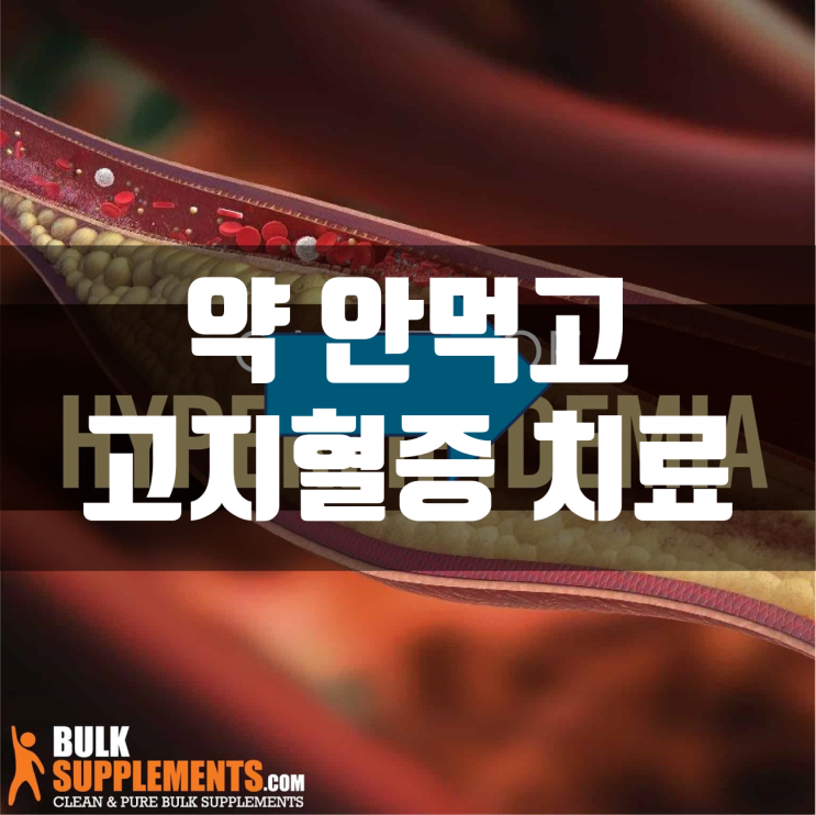 약 안먹고 고지혈증 치료하기 콜레스테롤낮추는법 원인 증상 수치 음식 운동 영양제 네이버 블로그