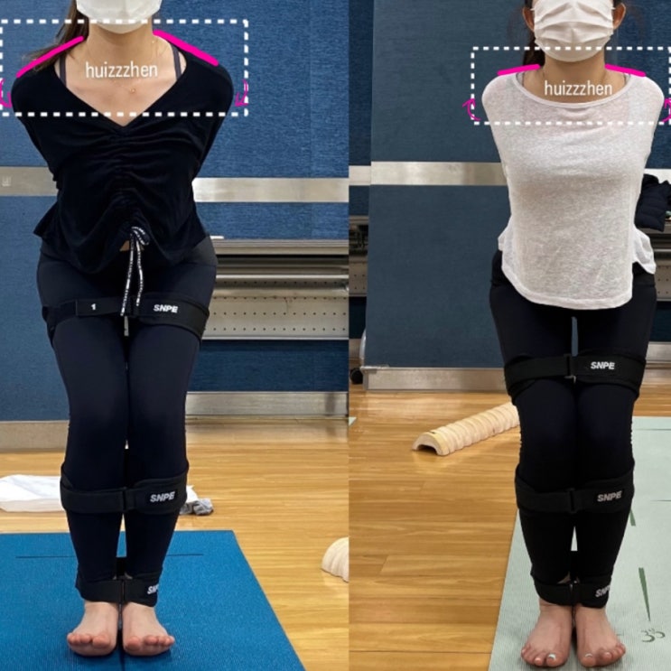 [전후비교] SNPE 인천 부평 삼산 롯데마트 문화센터 삼산점 : 네이버 블로그