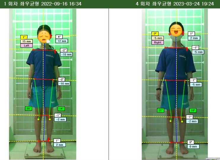 초등학생 자세교정하고 초5 평균키를 향해 나아가는 키성장 사례 네이버 블로그