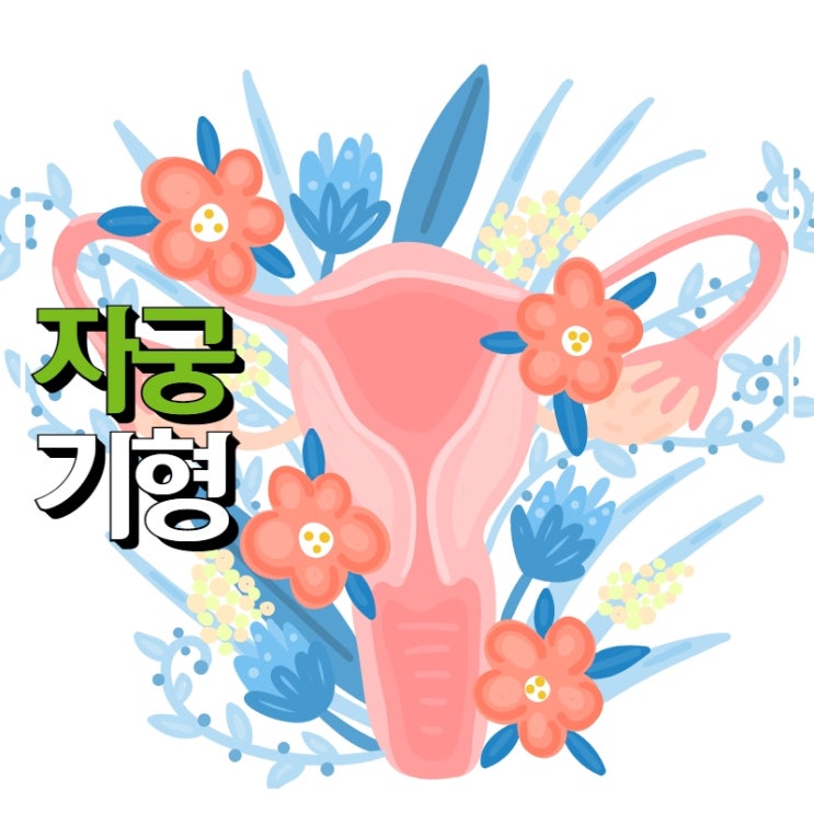 자궁기형 종류중복 쌍각 중격 단강 궁형 여성 난임 원인 증상자궁2개 네이버 블로그