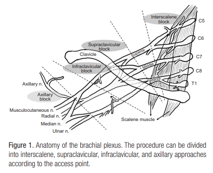 [정형외과 전문의] Brachial plexus block (Interscalene, supraclavicular ...