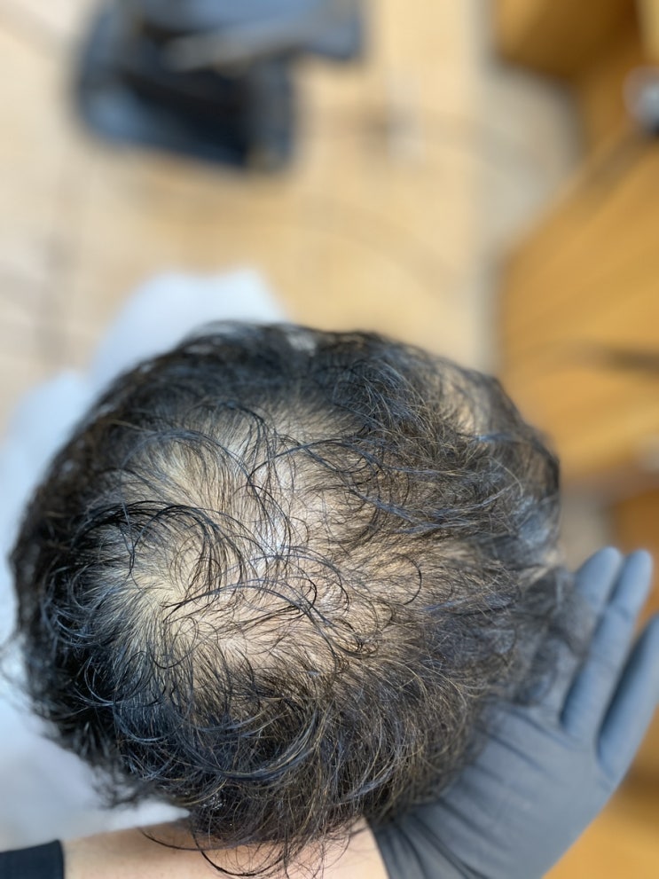 오래된중년탈모 내일부터는 꽃중년으로 부산탈모커버성형펌 사상탈모모라탈모하단탈모김해탈모거제탈모울산탈모양산탈모녹산탈모연제탈모동래탈모