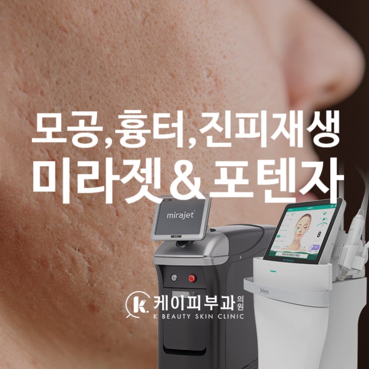 센텀피부과모공 흉터 진피 재생 효과 미라젯 포텐자 레이저 가격 네이버 블로그