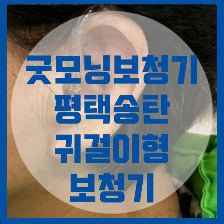 굿모닝보청기 평택 송탄센터 80대 고객님 청각장애 지원 Bte 귀걸이형 보청기 만족 착용사례 네이버 블로그