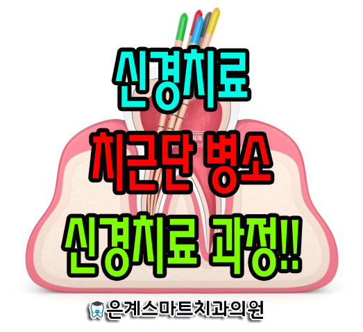 치근단 병소신경치료 증례 신경치료는 어떻게 진행되나요은계지구 신경치료 잘하는곳 네이버 블로그