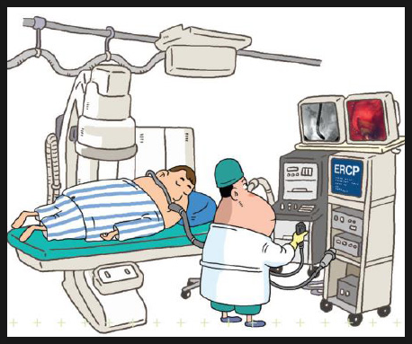 ERCP : 네이버 블로그