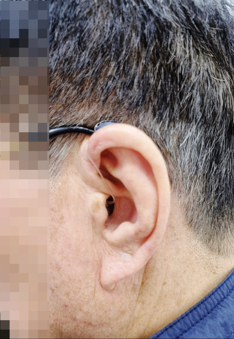 밀양보청기밀양독일보청기밀양시그니아독일보청기공식인정 전문센터~ 최고급형 보청기 착용하신 아버님~ 네이버 블로그