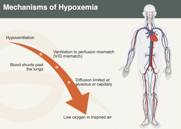 "니들 이거 알아?" - hypoxemia vs. hypoxia : 네이버 블로그
