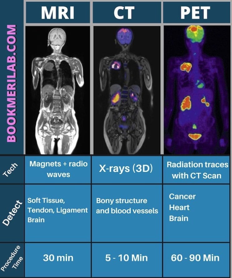 CT, MRI, PET 차이점 (CT, MRI, PET, What’s the difference?) : 네이버 블로그