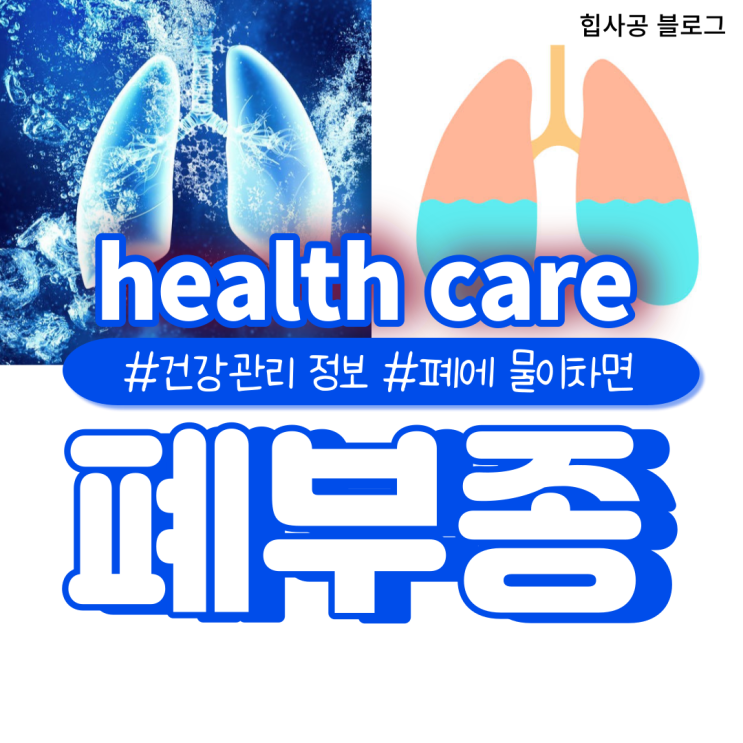 폐에 물이차면 폐부종 증상 치료 물이차는 이유 원인 물빼기 심부전 네이버 블로그