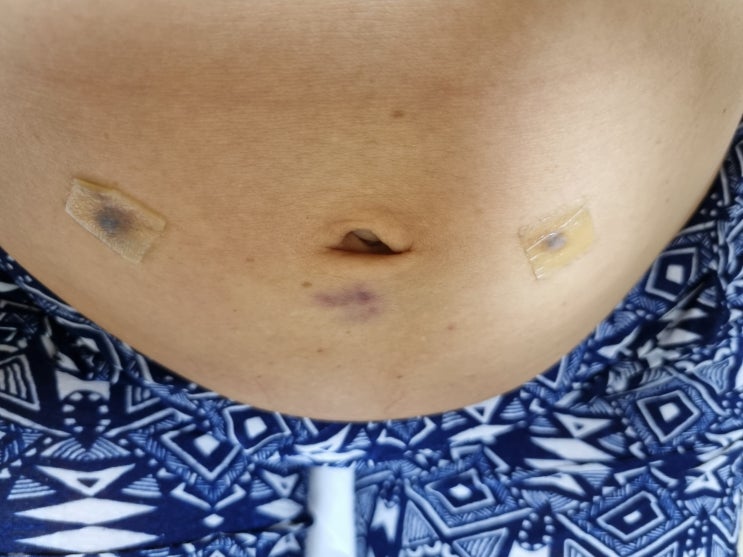 샤인빔 S걸그룹주사 3회차 : 네이버 블로그