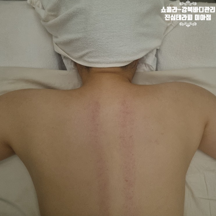 미아사거리체형관리 진심테라피점 강북바디관리 에서 등관리 받기 네이버 블로그