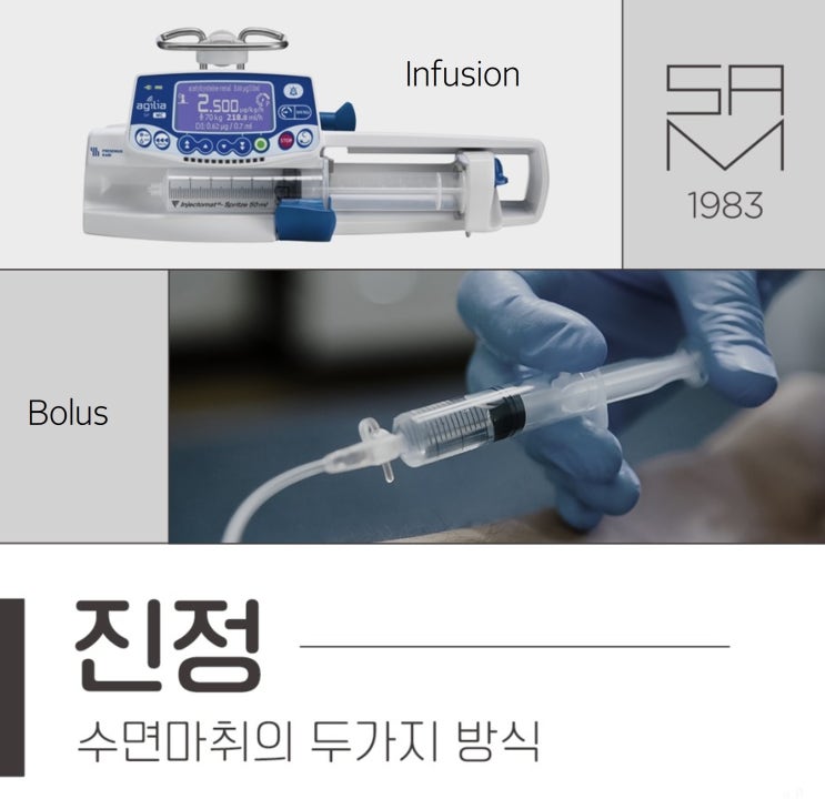 진정) 수면마취의 두가지 방식: Bolus(일시주입) , Infusion(지속주입) : 네이버 블로그
