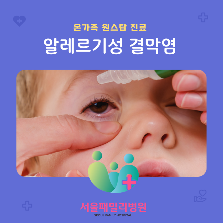 봄철 꽃가루 어린이 알레르기성 결막염 원인과 주의사항 네이버 블로그