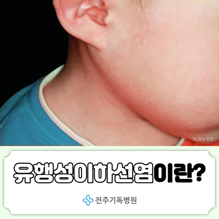 볼거리유행성이하선염 증가 전염여부 증상 알아보자 네이버 블로그