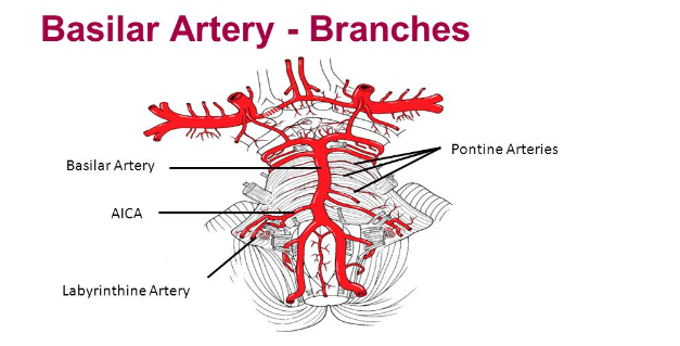 top of the basilar syndrome : 네이버 블로그