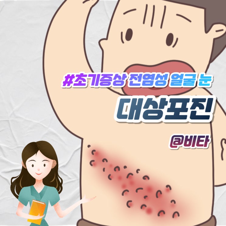 대상포진 초기증상 대상포진 후 신경통 전염성 얼굴 눈 약 네이버 블로그