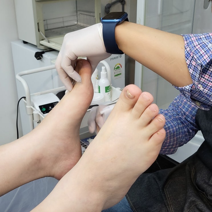미사역 여름맞이 발각질관리 패디플래닝 오츠데이 네이버 블로그