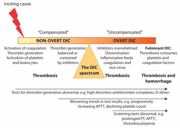 개의 파종성 혈관내 응고 (Disseminated Intravascular Coagulation, DIC) : 네이버 블로그