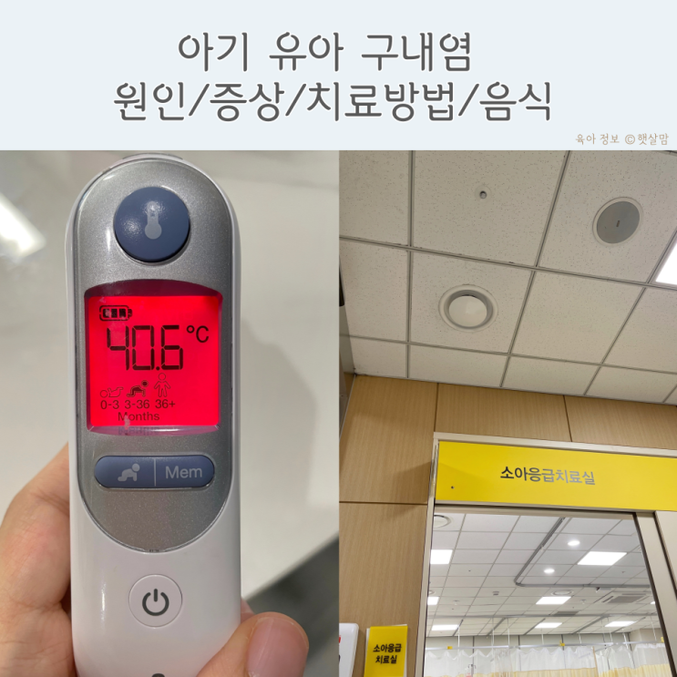 아기 유아 구내염 원인과 증상 열 치료약 연고 구내염 빨리 낫는법 전염력 어린이집 등원언제부터 네이버 블로그