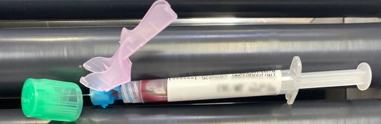 ABGA 동맥혈 가스 분석 검사란? 검사결과 해석방법! : 네이버 블로그