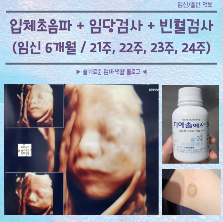 임신 21주 22주 23주 24주 (임신 6개월) 증상 : 입체초음파, 임당검사, 빈혈검사 : 네이버 블로그