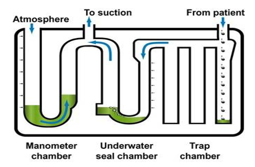 Chest bottle(ATRIUM, SINAPI, THOPAZ), 저압지속흡인기 : 네이버 블로그