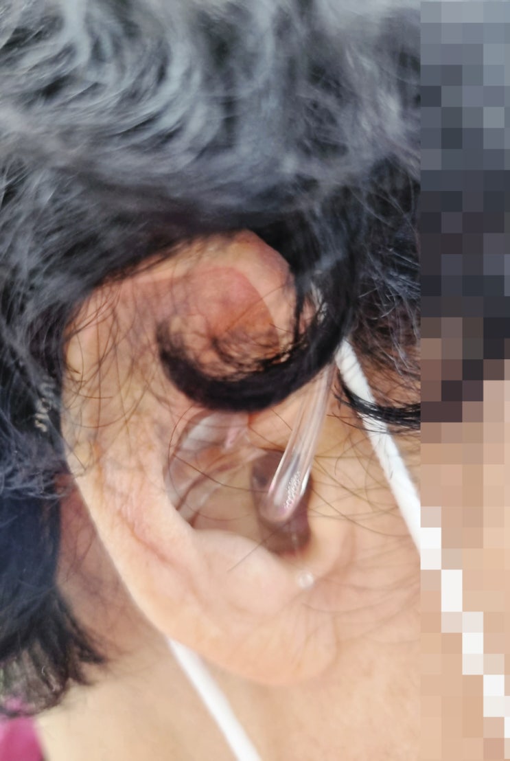 밀양보청기밀양독일보청기밀양시그니아독일보청기공식인정 전문센터~ 보청기도 청신경이 살아있어야 소리를 들을수 있어요