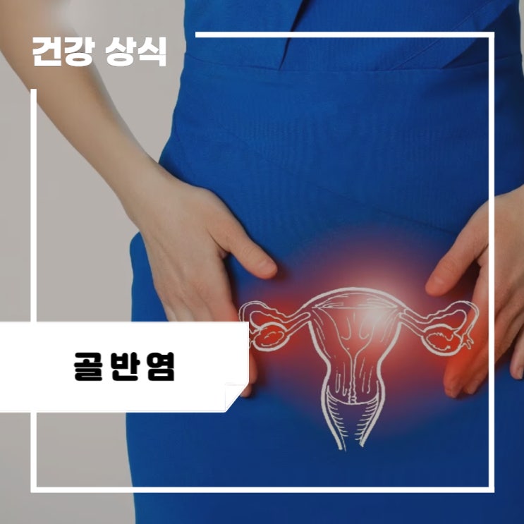 골반염 증상 및 원인 치료 검사 통증 위치 성병 유무 네이버 블로그