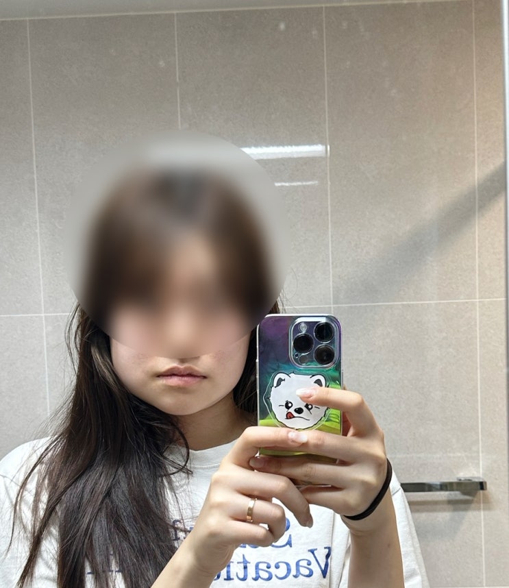 사랑니 발치후기 거울속에 넌 누구니 네이버 블로그