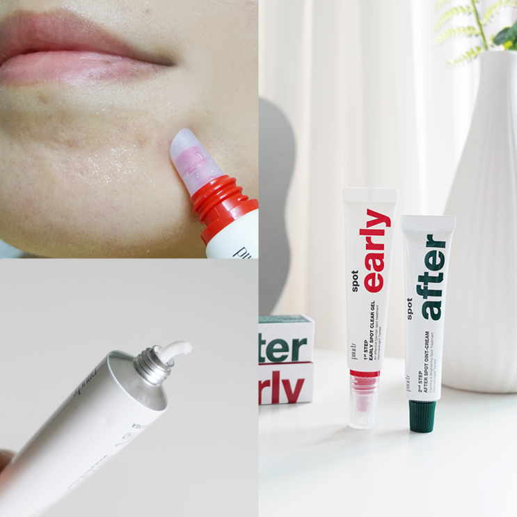 청소년 여드름 화장품 피어브 뾰루지 여드름 연고 착색 흔적까지 2단계 케어 네이버 블로그