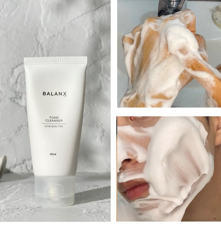 BALANX 살리실산 폼클렌징추천 남자 좁쌀여드름세안제 케어 후기 : 네이버 블로그