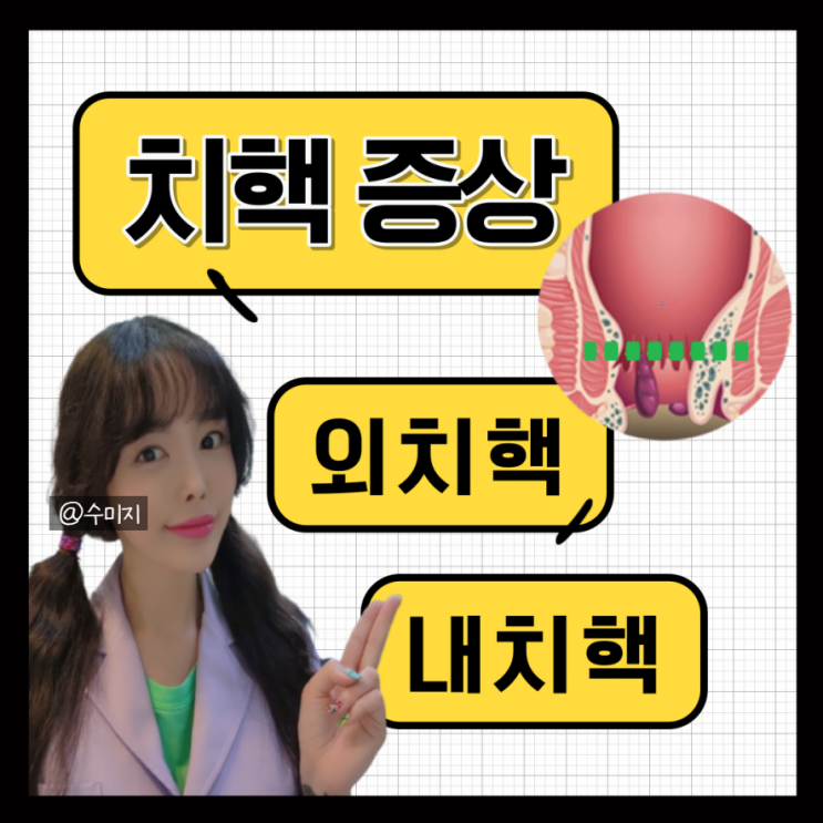 치핵 증상 외치핵 내치핵 증상 항문 따가움 부음 통증 출혈 치질 가려움 피 탈항 항문질환 네이버 블로그