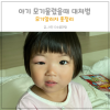 아기 모기 물렸을때 방법 패치 리도맥스 에스로반 연고 외 모기알러지 꿀팁 총정리 네이버 블로그