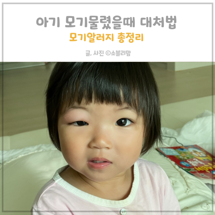 아기 모기 물렸을때 방법 패치 리도맥스 에스로반 연고 외 모기알러지 꿀팁 총정리 네이버 블로그