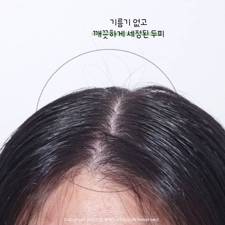 올리브영 약산성샴푸 지성두피 손상모발케어 클로란 으로 관리하는 방법 네이버 블로그