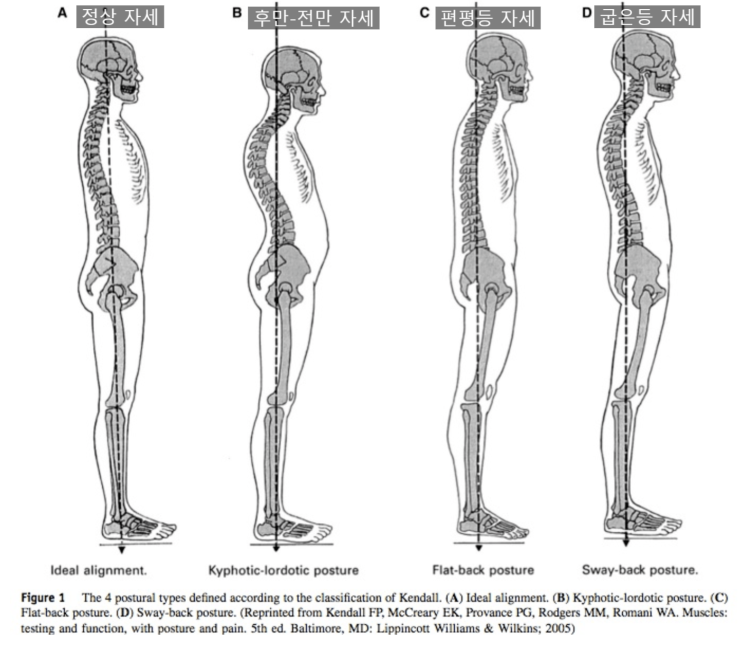 켄달의 체형 분류, 자세 유형 (Kendall's Postural Types) : 네이버 블로그