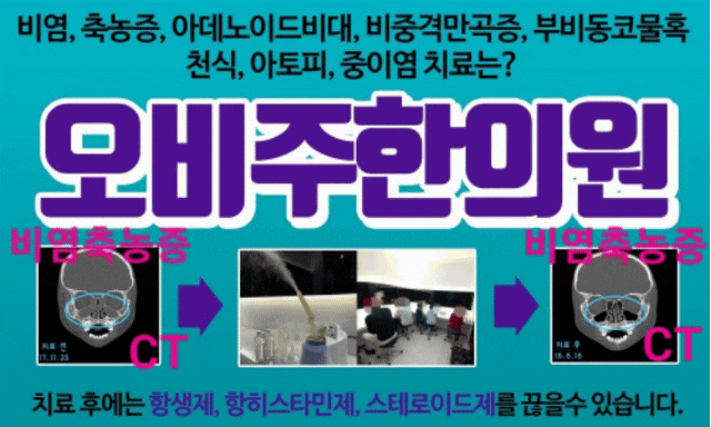 강남 유아축농증 증상아기축농증 어린이축농증 치료 축농증중이염 축농증기침 축농증열축농증코막힘 항생제 치료 청담동